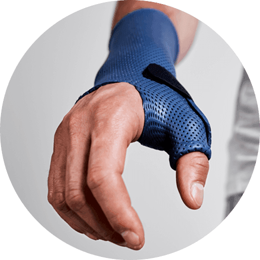Orficast | Yoke orthosis index finger